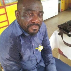 8 Different Types of Resting Face | Zikoko!