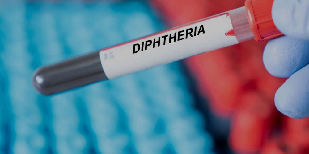 Diphtheria Outbreak: What You Need to Know | Zikoko!